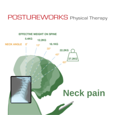 Neck Posture Case Study - Postureworks Los Angeles | Physical Therapy ...